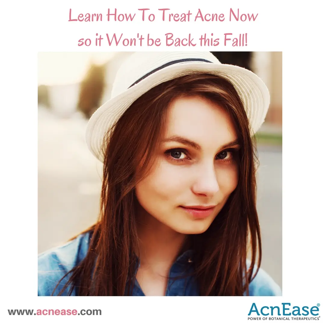 How to Treat Acne Now So That it Won’t be Back This Fall | Blog